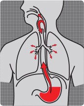 The Connection Between Gastric Reflux, Obstructive Sleep Apnea, & Diet